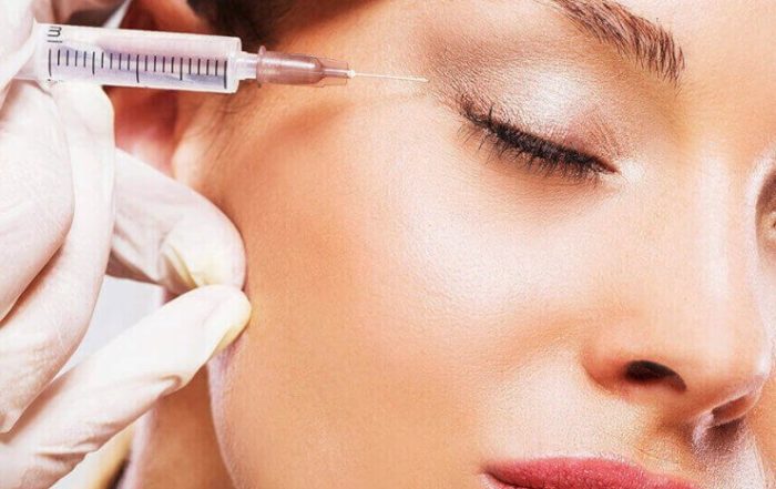 Botox - Lepo lice